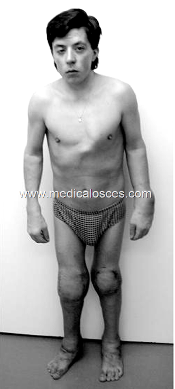 Identify This Genetic Defect ~ Medical Osces